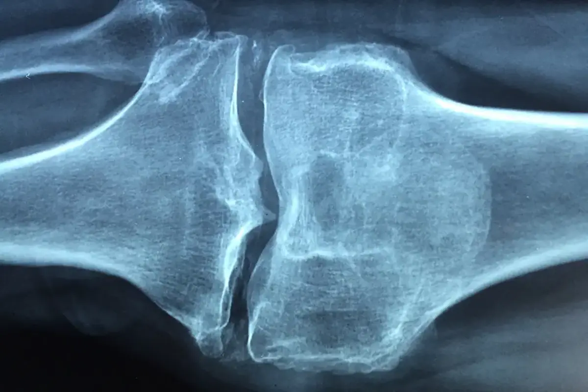 X-ray - Procare Radiology